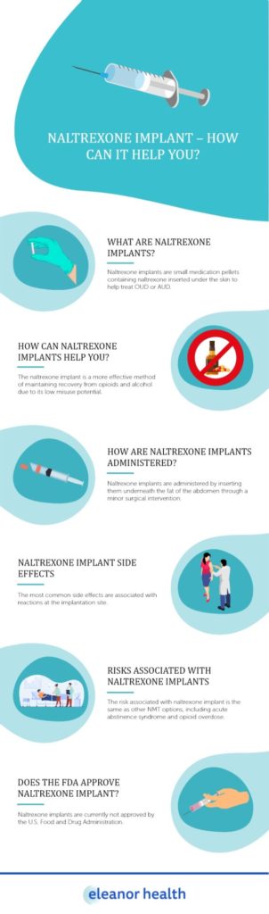 Naltrexone Implant – How Can it Help You?